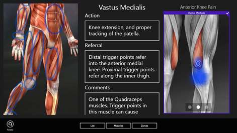 Vastus Lateralis Trigger Points The Knee Pain Trigger Knee Pain Basics