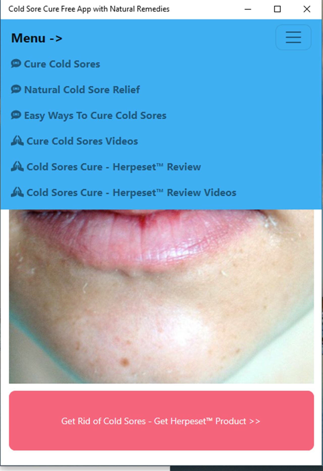 Natural Treatment For Cold Sore
